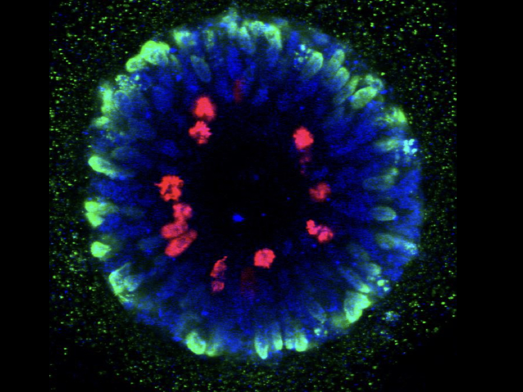 PVDHLAB.ORG - Microcephaly genes / linking neurogenesis and evolution ...