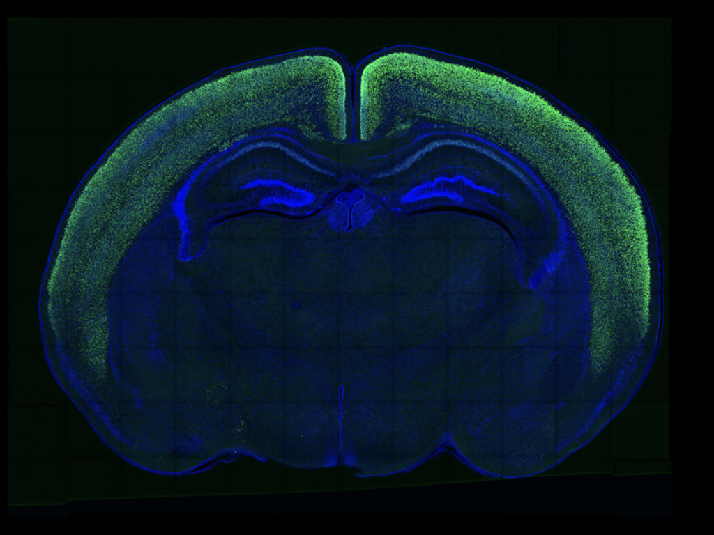 PVDHLAB.ORG - Human-specific genes, cortical development, and brain ...